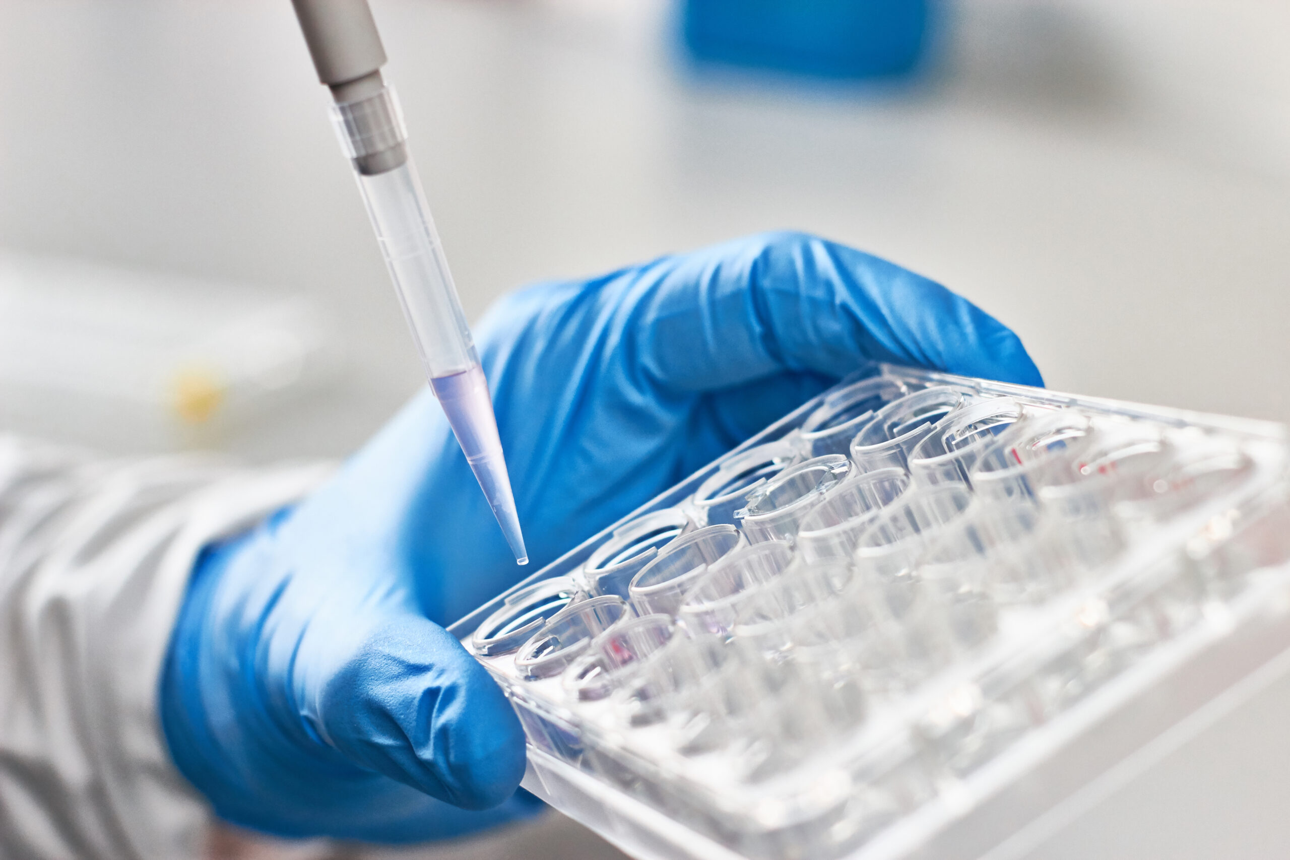 Tofersen receives positive opinion from European Medicines Agency ...